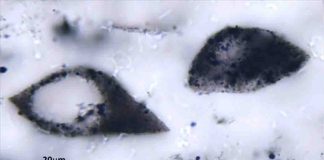 Plankton Archives | Geology Page